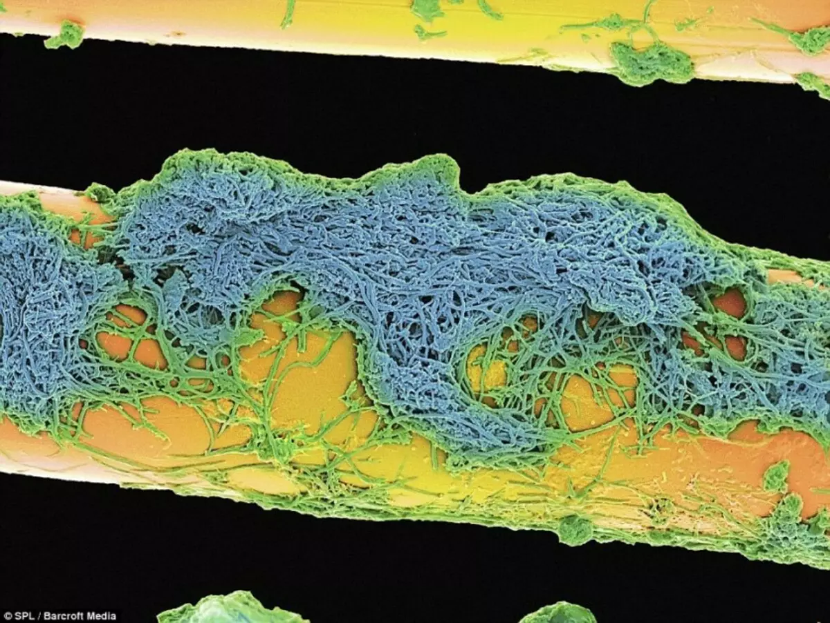 Qual è il microworld nella nostra bocca? 8613_13