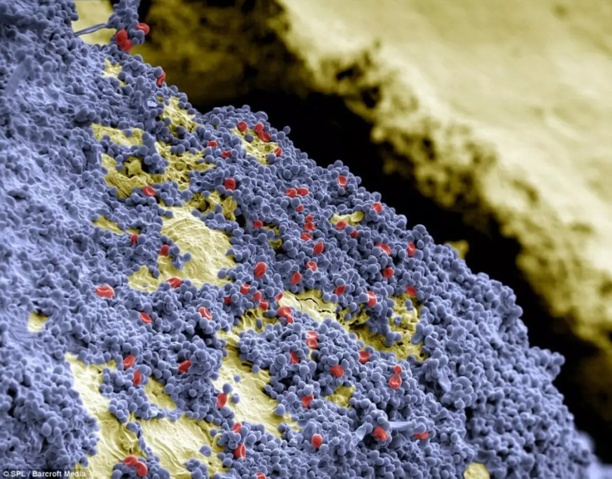 Qual è il microworld nella nostra bocca? 8613_20